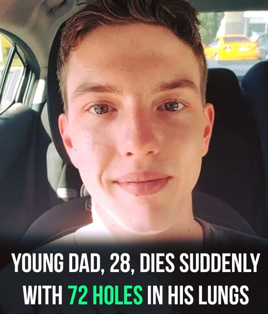 Discover 72 Lung Holes: The Story of Dylan Jay Watts – Blue Peak